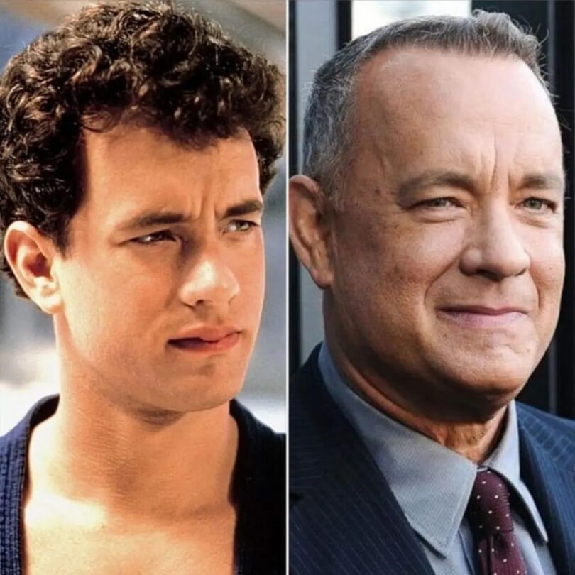 Tom Hanks Plastic Surgery Photos [Before & After] - Surgery4