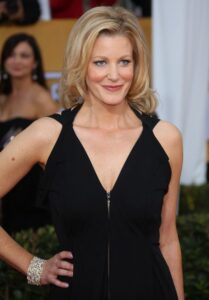 Anna Gunn Plastic Surgery Photos [Before & After] - Surgery4