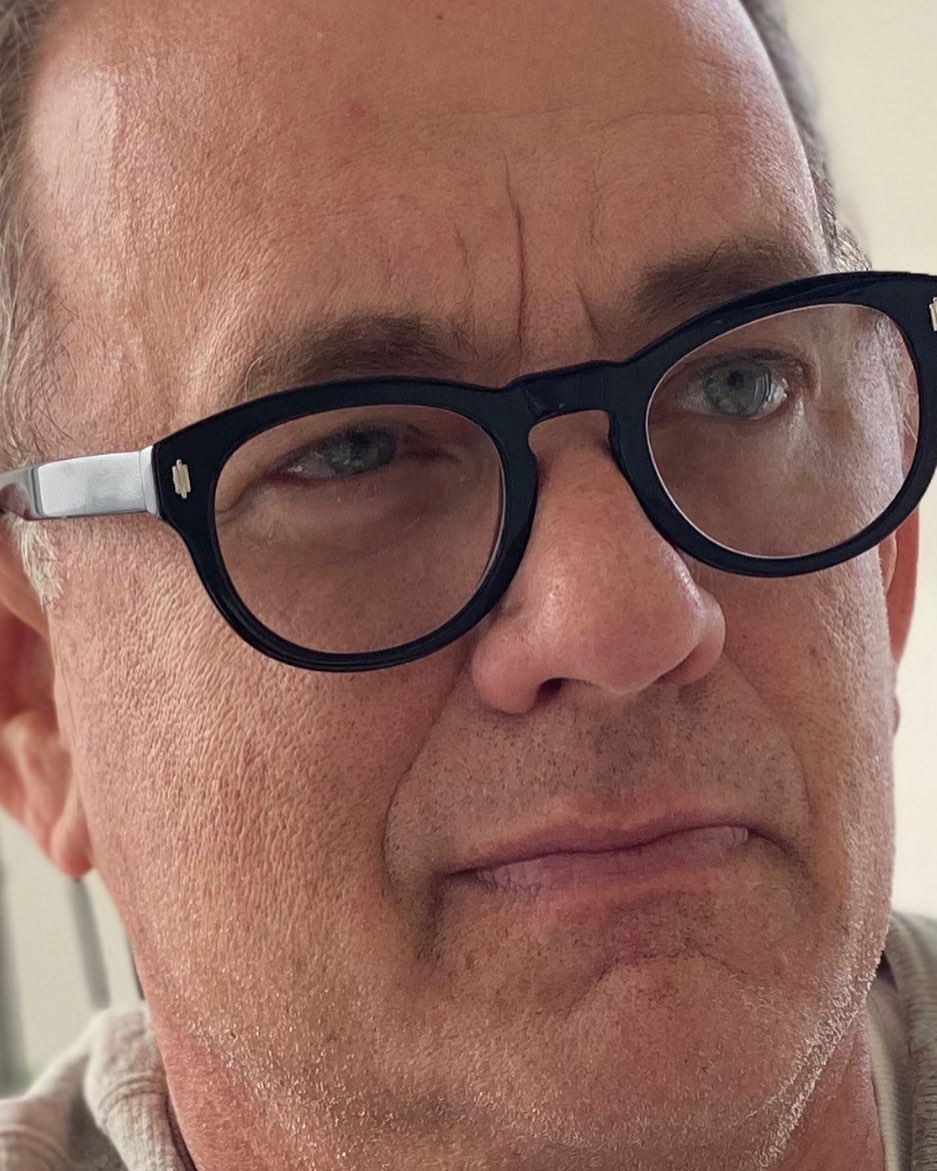 Tom Hanks Plastic Surgery Photos [Before & After] - Surgery4
