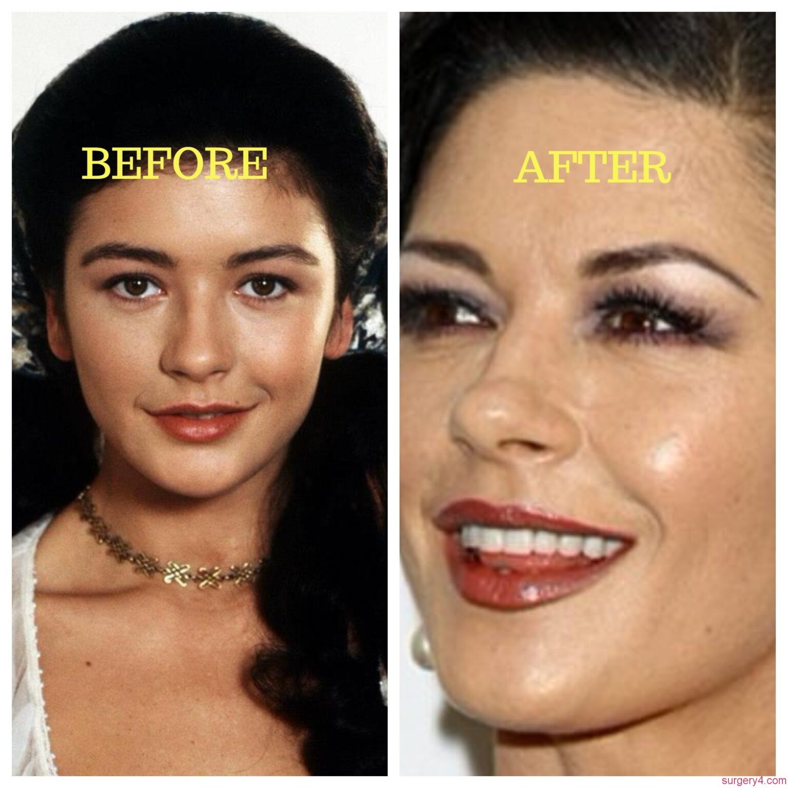 Catherine Zeta Jones Nose Job Photos [Before & After] - Surgery4