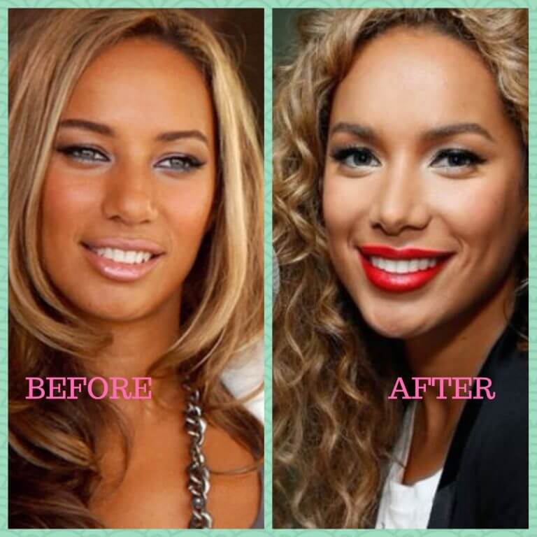 Leona Lewis Nose Job Photos [Before & After] - Surgery4