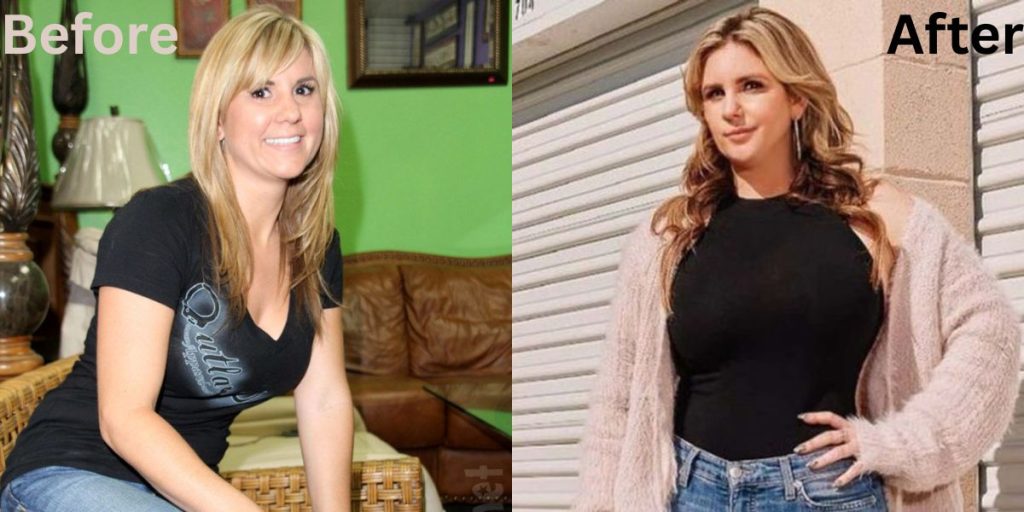 Brandi Passante Plastic Surgery Photos Before And After Surgery4