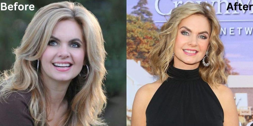 Brandi Passante Plastic Surgery Photos Before And After Surgery4